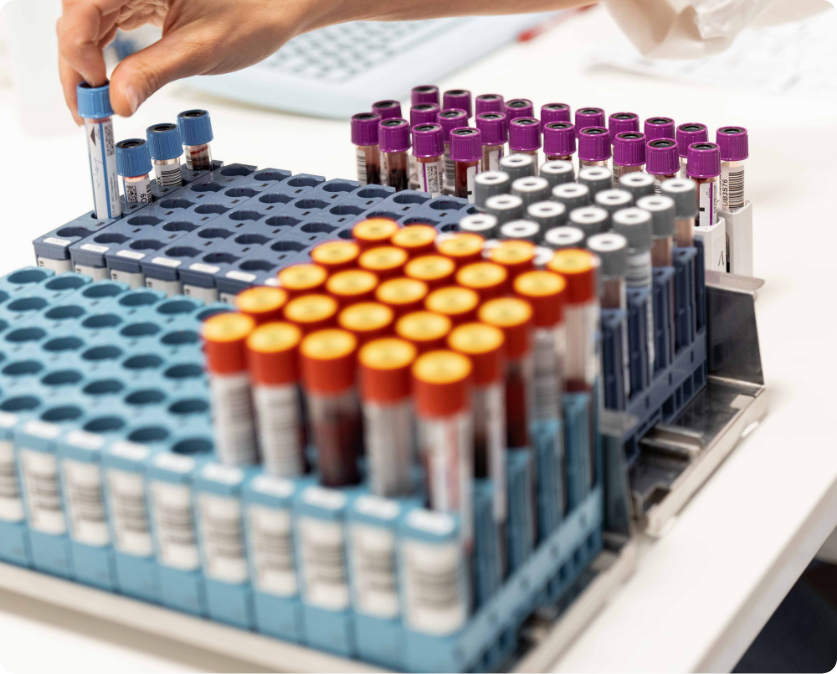 Prikcentra | Medisch Labo Bruyland